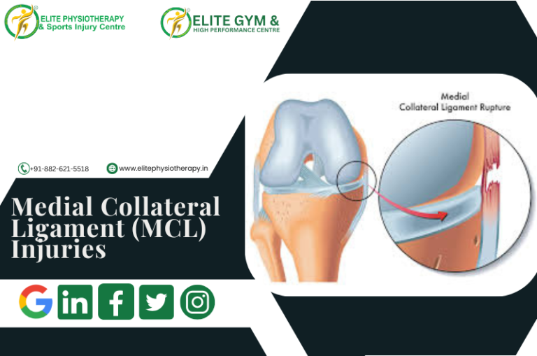 Medial Collateral Ligament Injuries Archives - Elite Physio Therapy