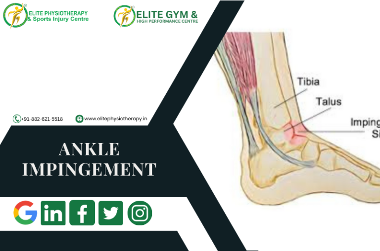 Ankle Impingement - Elite Physio Therapy