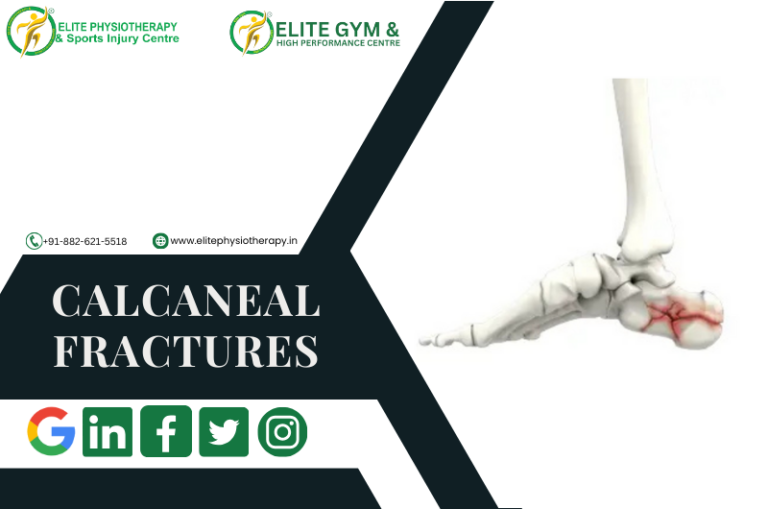 Calcaneal Fractures and its Best Management | Elite Phy