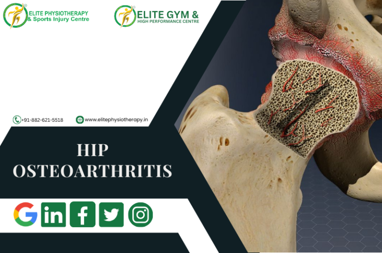 Hip Osteoarthritis and its Treatment without Surgery | Elite Physio