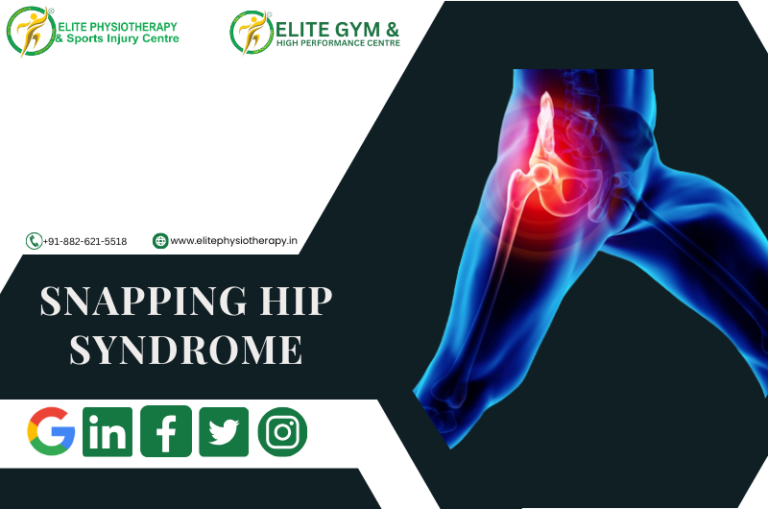 Snapping Hip Syndrome (SHS) and its Physiotherapy Treatment