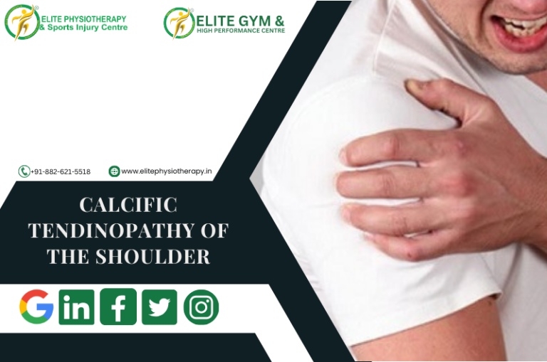CALCIFIC TENDINOPATHY OF THE SHOULDER | Elite Physio