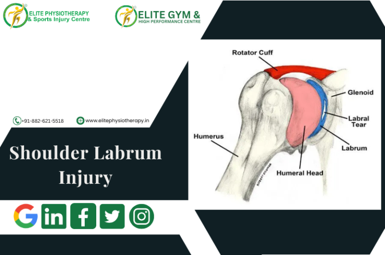 Shoulder Labrum Injury: Physiotherapy Management at Elite