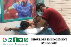 Shoulder Impingement Syndrome Archives - Elite Physio Therapy